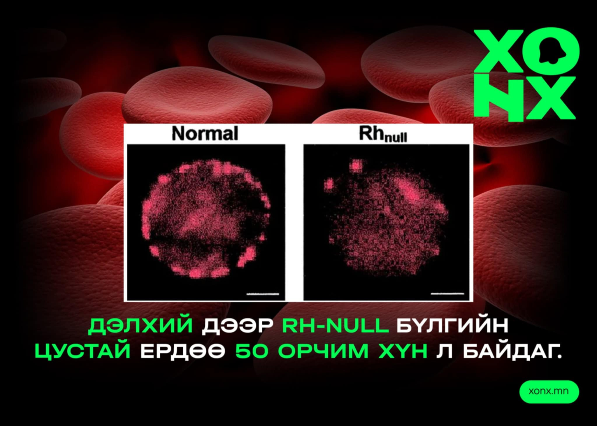 🔔МЭДЭЭЛЭЛ | ДЭЛХИЙ ДЭЭР RH-NULL БҮЛГИЙН ЦУСТАЙ ЕРДӨӨ 50 ОРЧИМ ХҮН Л БАЙДАГ